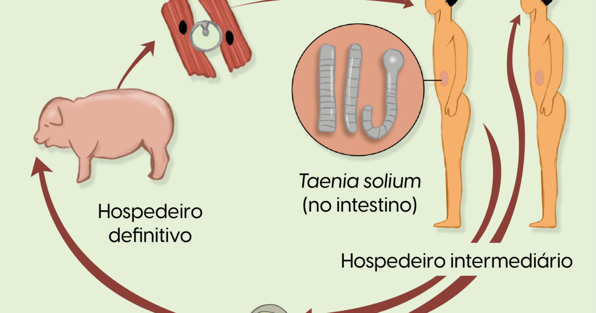 Neurocisticercose: sintomas, diagnóstico e tratamento da cisticercose ...