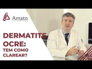 Dermatite ocre. Tem como clarear as manchas nas pernas? - Amato